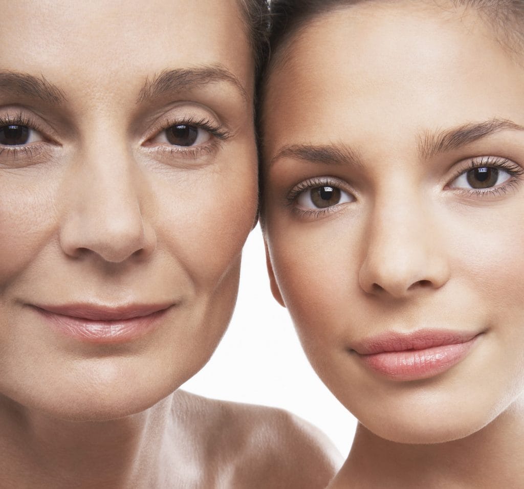 Skin sagging - skin folds and deep lines - Belgravia Dermatology