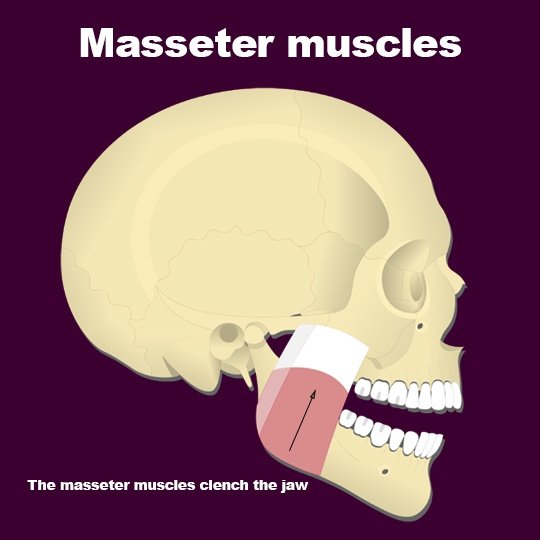 Botox for masseter muscles in London for face slimming and teeth grinding